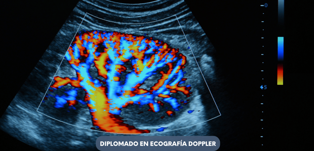 Ecografía Doppler | Postgrado UNE